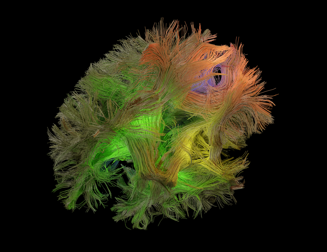 A flexible and accurate AI algorithm for neurotechnologies | Research ...