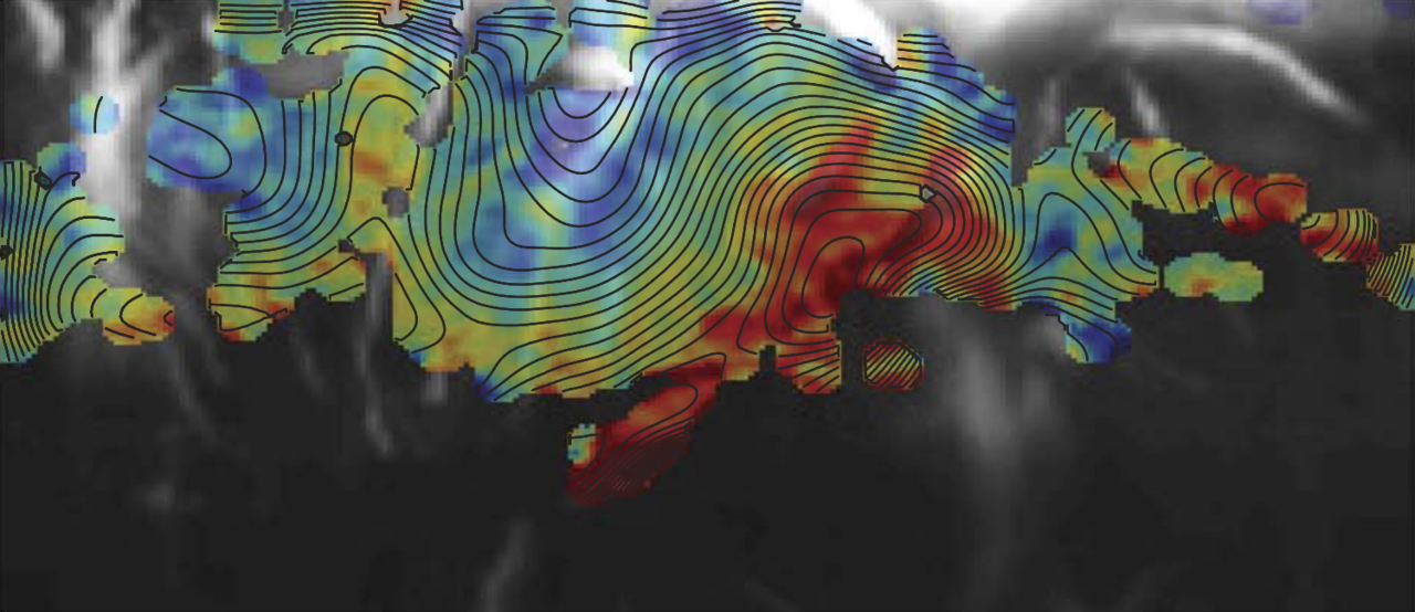 fUSing brain waves with blood volume | Research Communities by Springer ...
