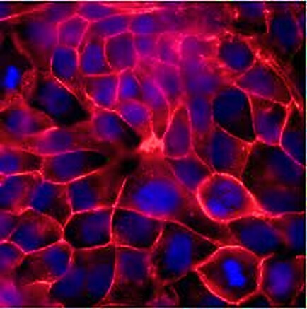The influence of mechano-active ion channels during kidney stone ...
