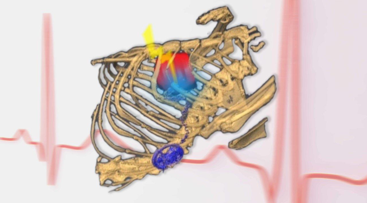 Wireless, battery-free, fully implantable multimodal and multisite ...