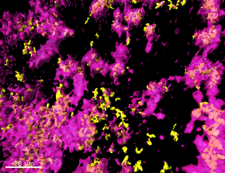 Co-infecting microbes impact pathogen gene essentiality during ...