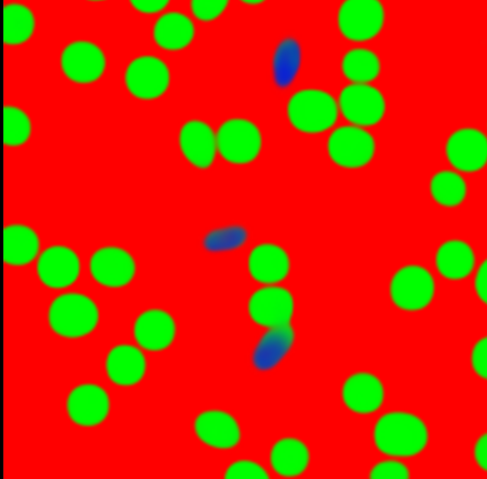 Deep learning-based screening of sickle cell disease using a mobile microscope | Research ...