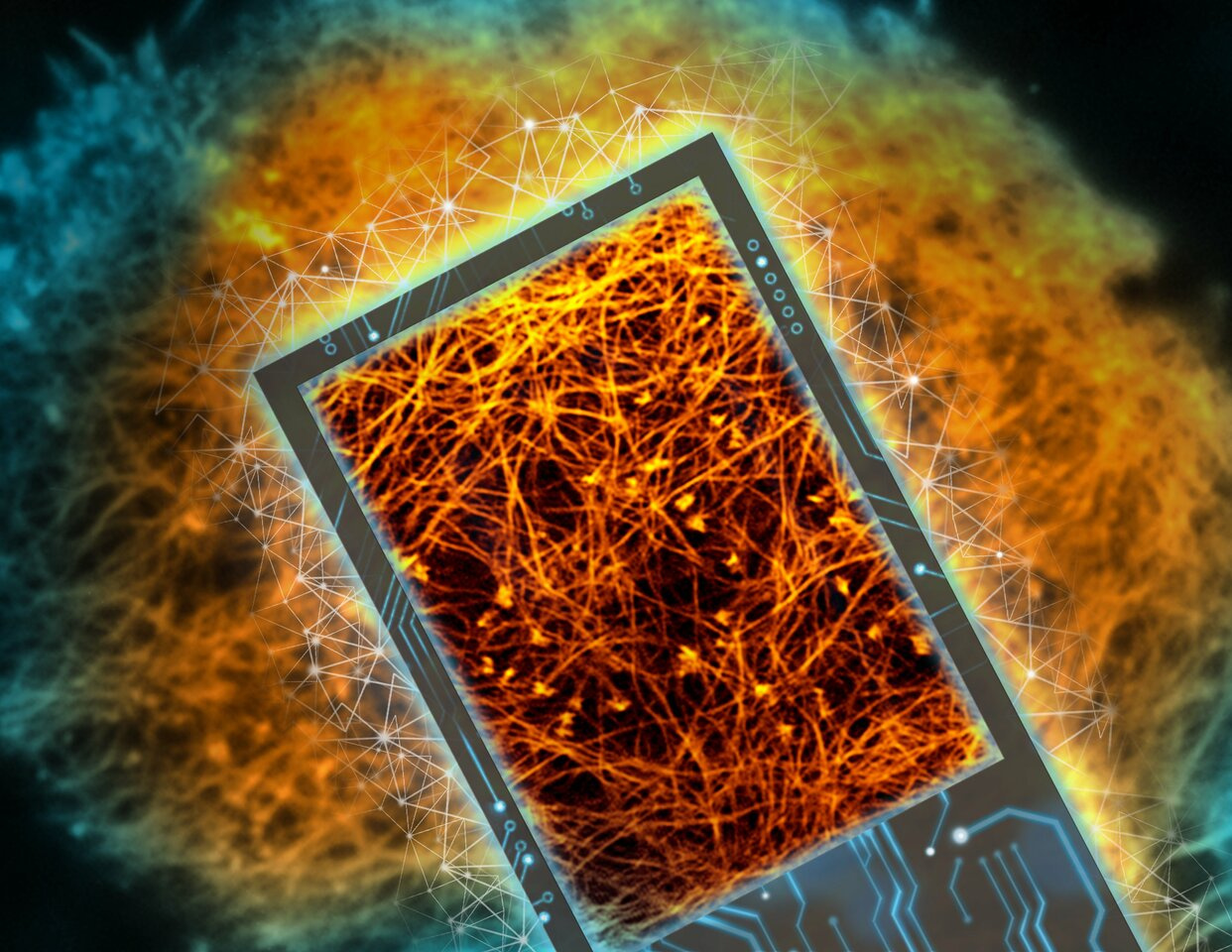 How To Make Deep Learning In Microscopy More Rational Research Communities By Springer Nature