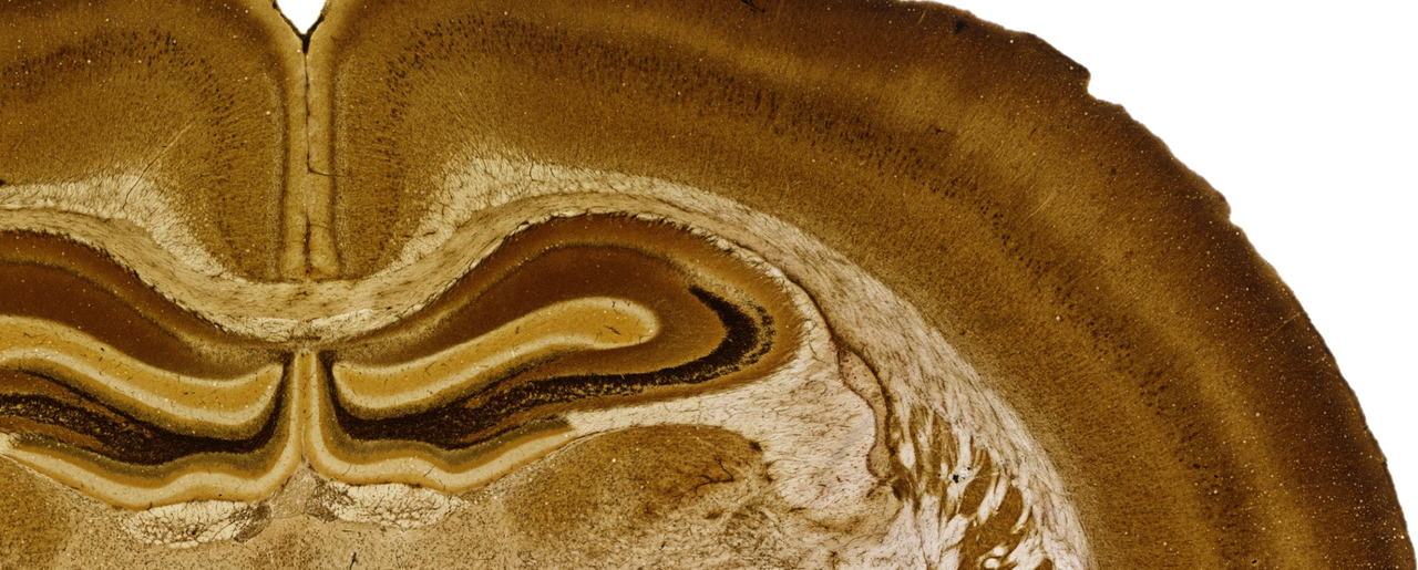 Finding gold in silver-stained rat brains | Research Communities by ...