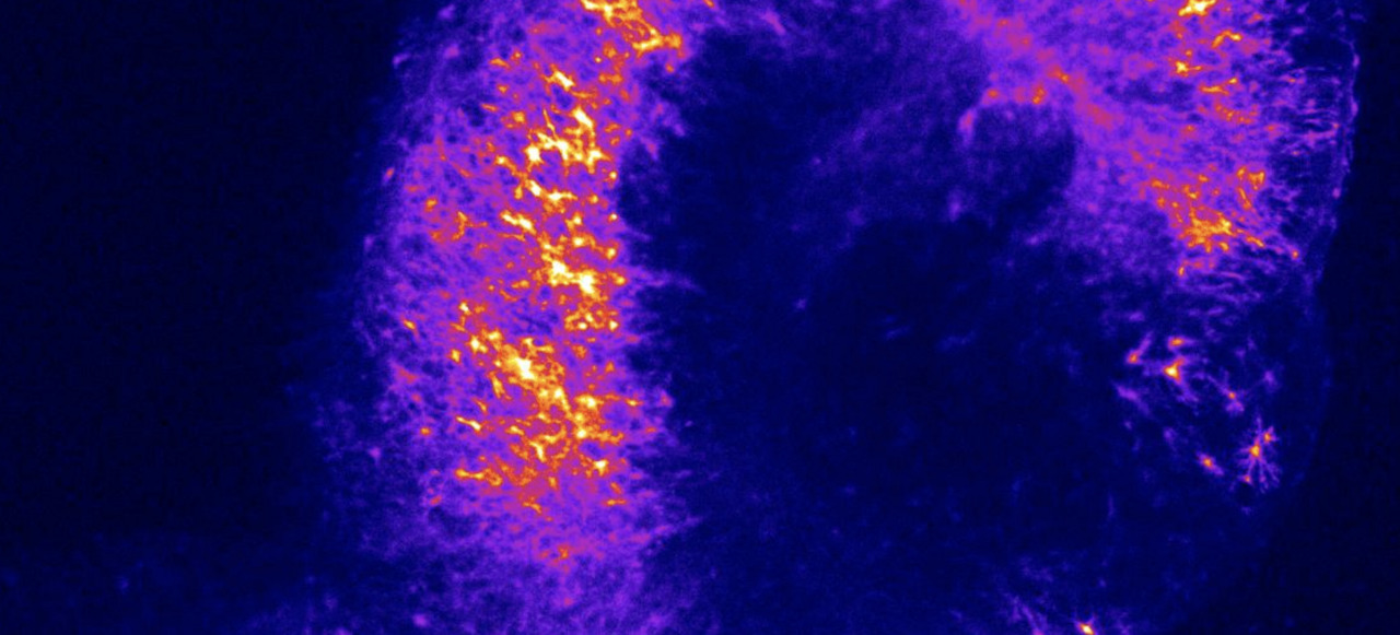 How does one express that calcium waves, to me, are what earthquakes ...