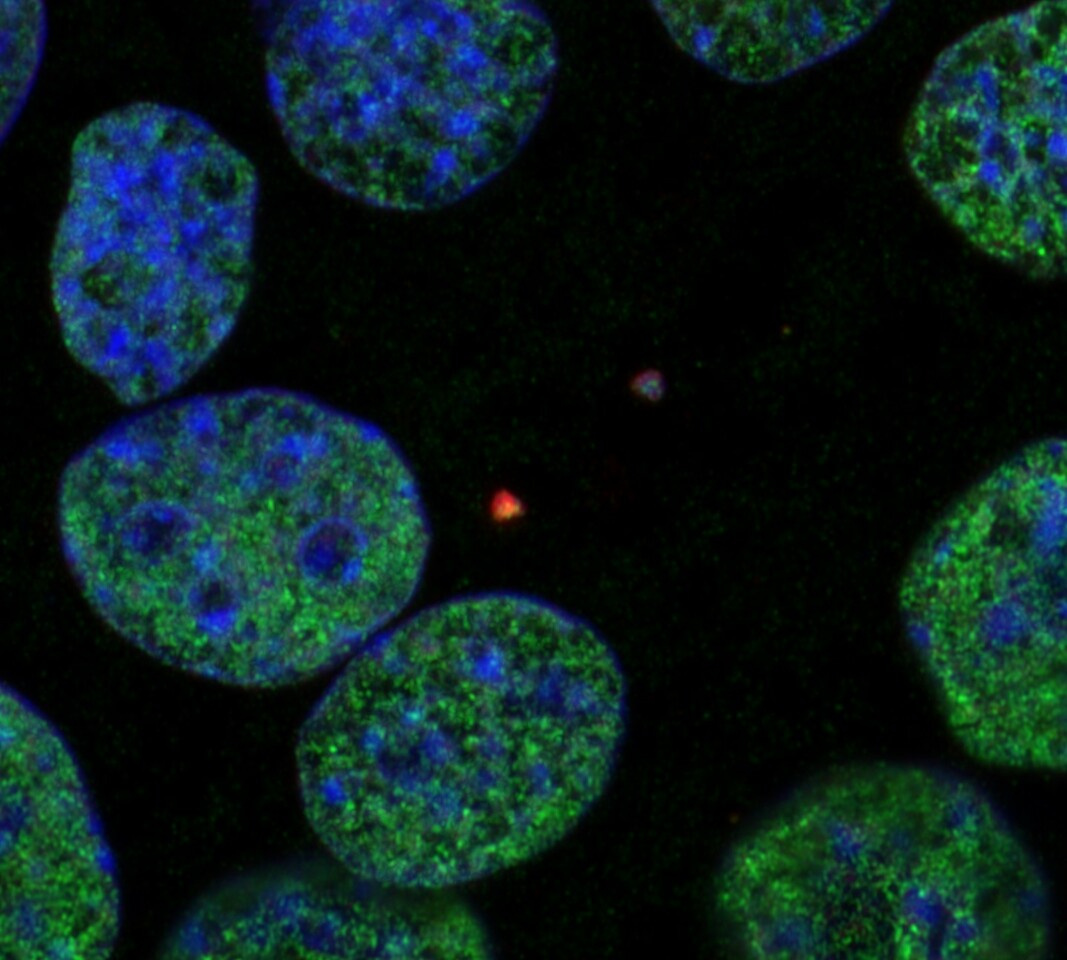Connecting the Dots: Epigenetic Abnormality and Chromosomal Instability ...