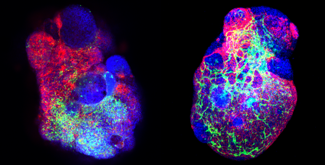 Growing patterned human primitive heart organoids via pluripotent stem ...