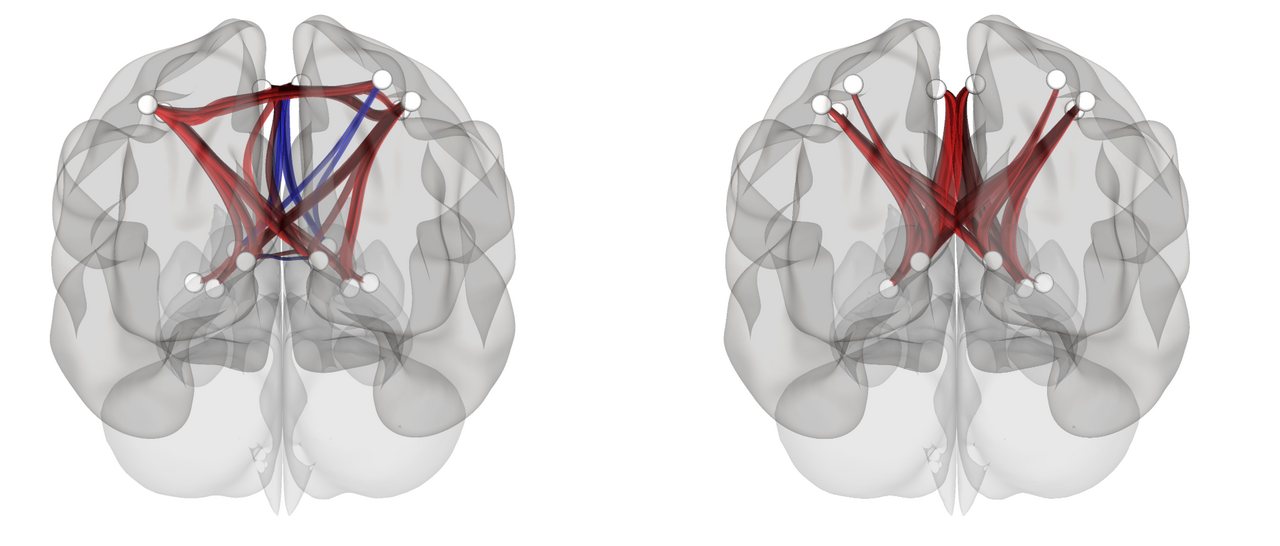 The neural signature of psychomotor disturbance in depression ...