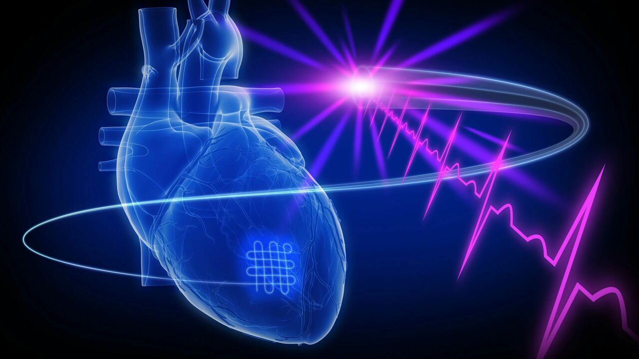 Two-way workable solution to infarcted heart: Hydrogel suture as a ...