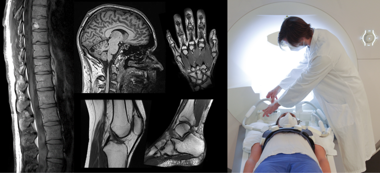 Citizen science approach to assessing patient perception of MRI ...