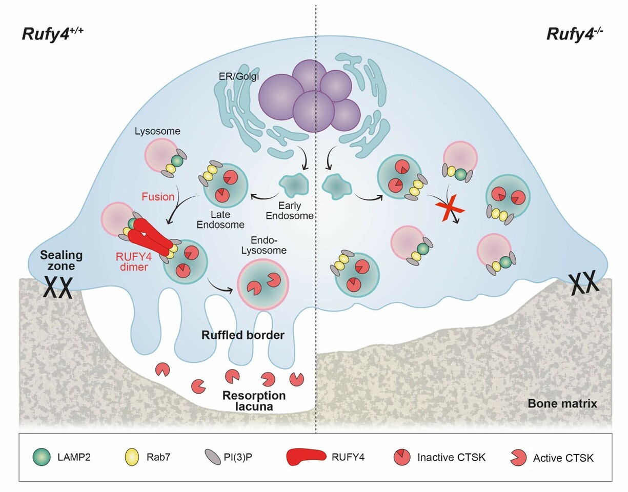 RUFY4 deletion prevents pathological bone loss by blocking endo ...