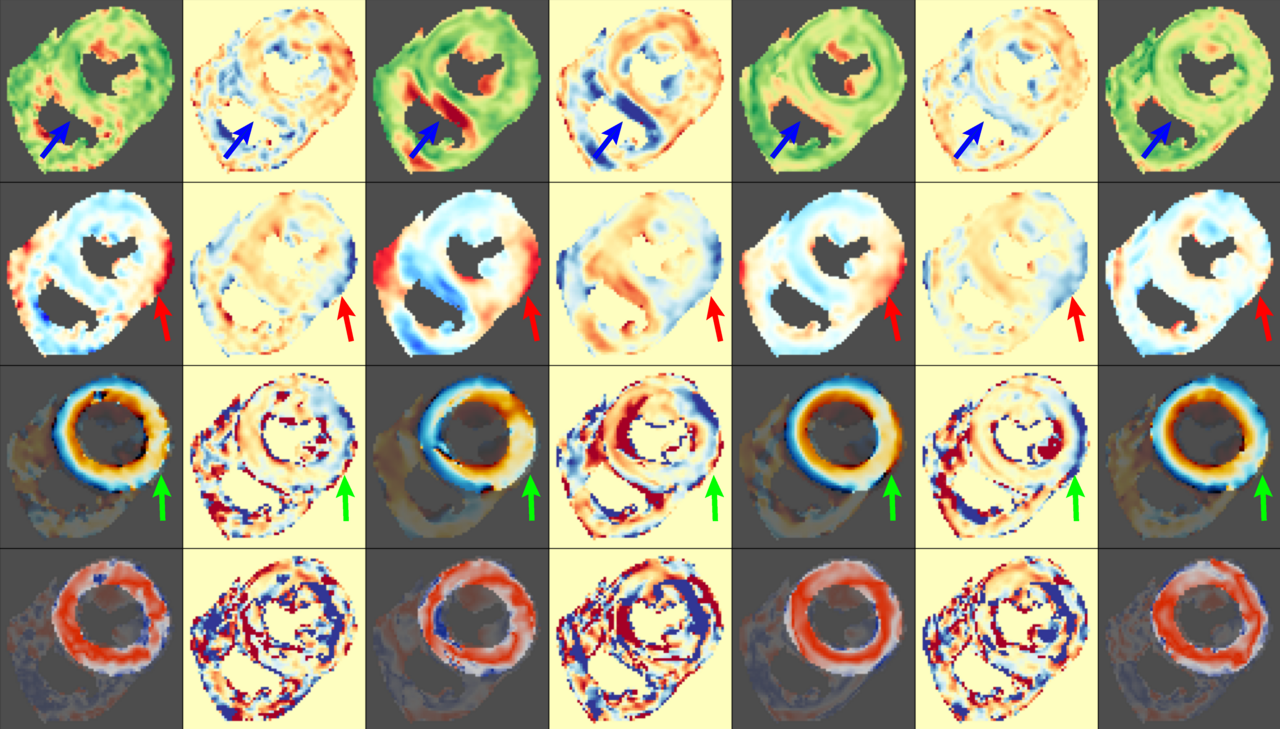Exploring The Potential Of Deep Learning In Cardiac Diffusion Tensor Imaging Reconstruction