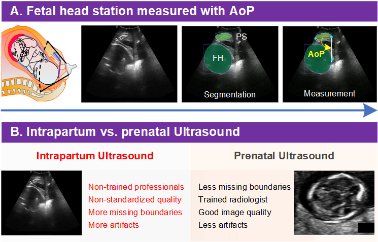 Obstetric Ultrasound Imaging and Biometry | Research Communities by ...