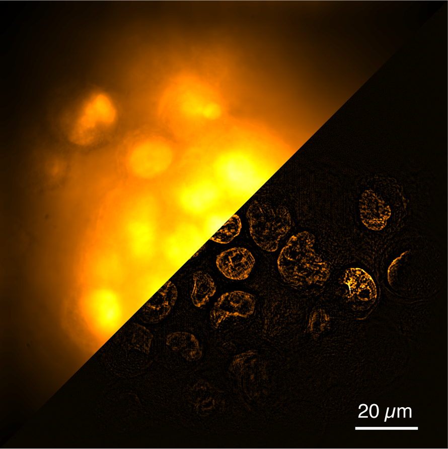 The Journey To Spa For Volumetric Structured Illumination Microscopy Research Communities By