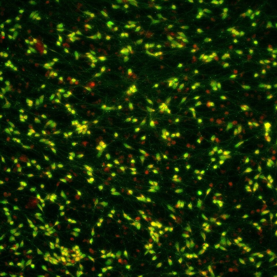 Behind the Paper: Exploring the neuroprotective potential of Nrf2 ...