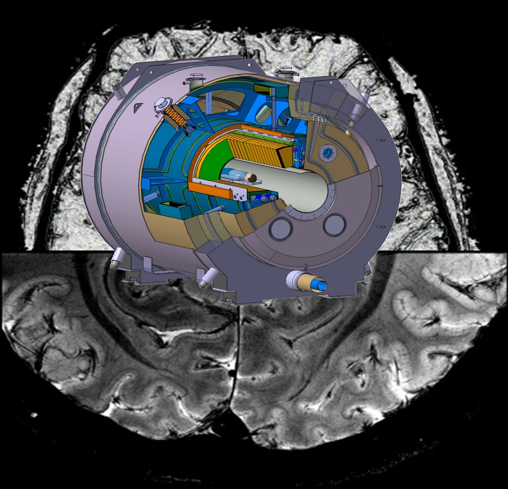 Ultra-high field for fast imaging of the human brain at mesoscale ...