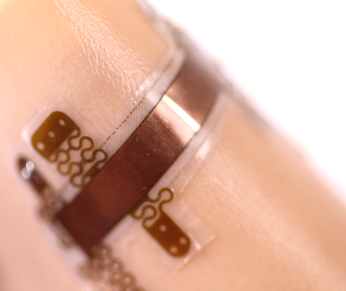A Wearable Device to Protect Dialysis Patients' Lifelines | Research ...