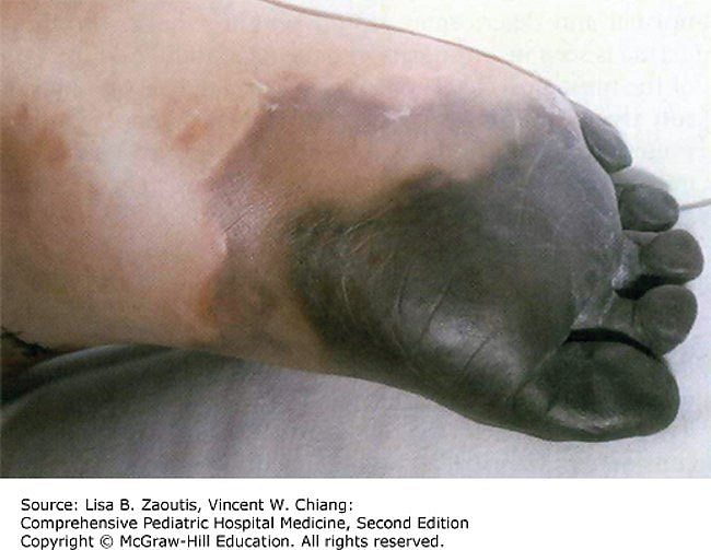 Fever and Rash Diagnosis | AccessMedicine Network