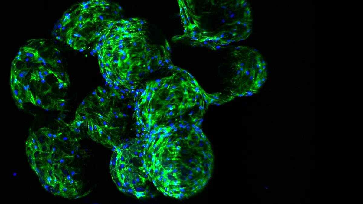 Cultured meat platform developed through the structuring of edible ...