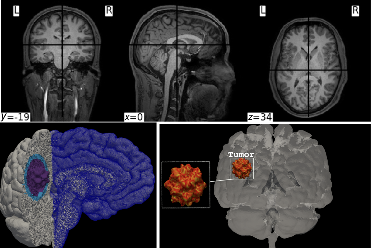 From Theory to Application: Improving Numerical Algorithms for Reaction-Diffusion Equations ...