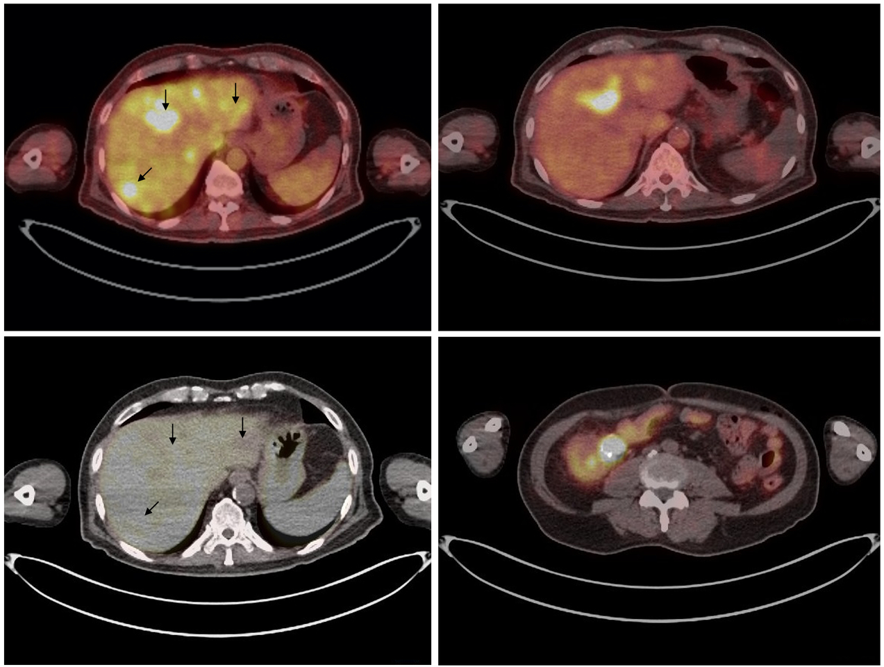 Behind the Paper: Onco-ontogeny recapitulates phylogeny – a ...